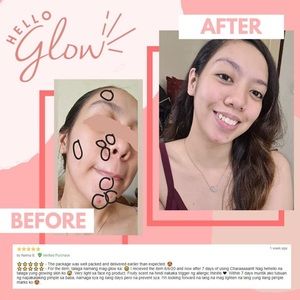 Hello Glow | Skincare | Hello Glow Whitening Set | Poshmark